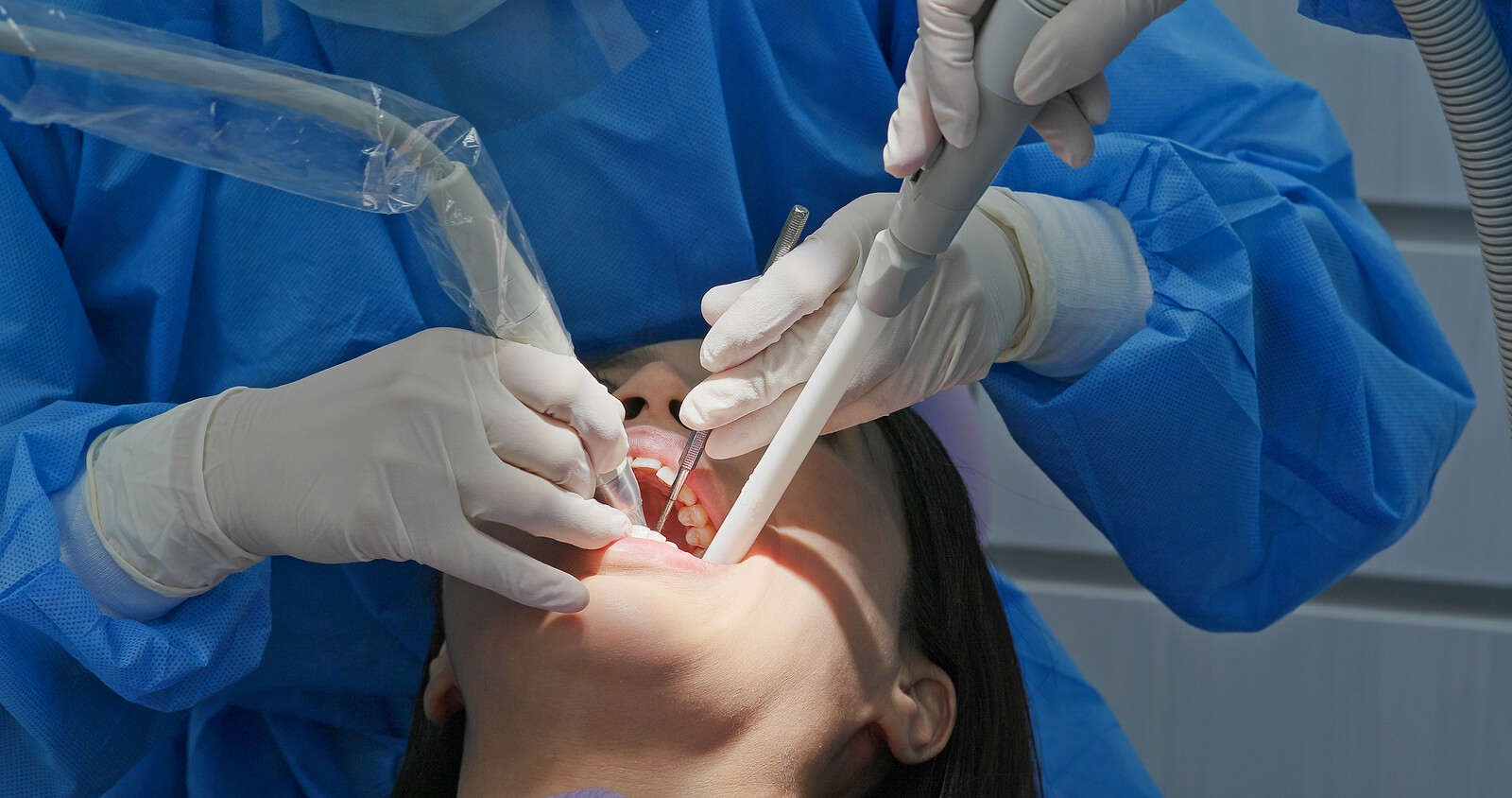 Dental Scaling Procedure Hygiene Benefits Types Of Deep Scaling Costs